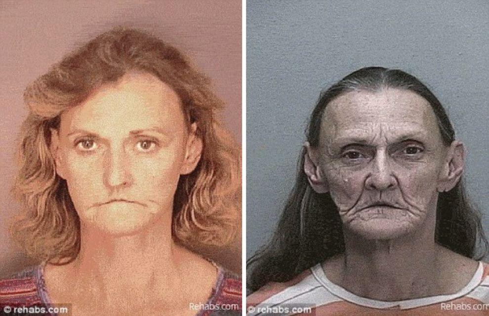 Gli effetti della droga sulle persone: prima e dopo! - Foto 1 di 5 ...