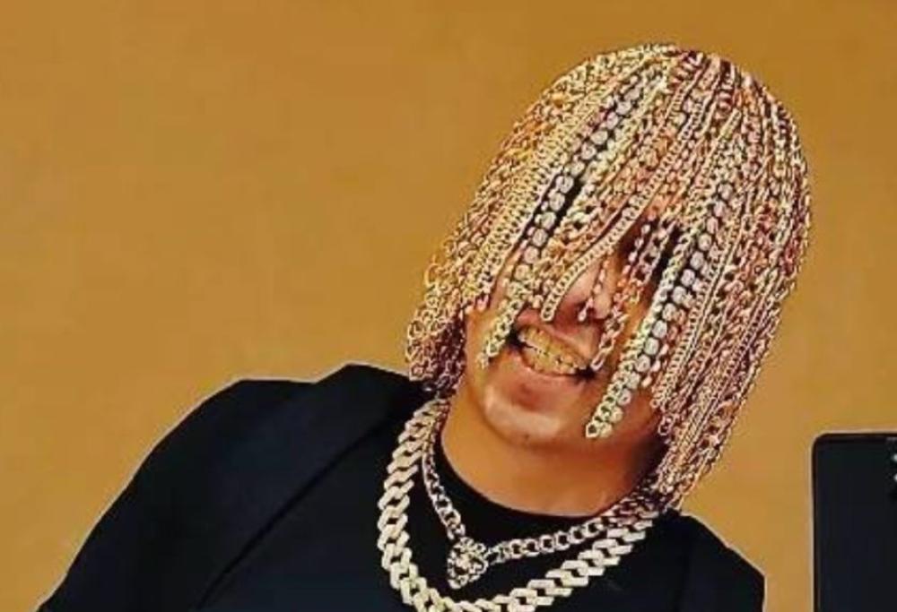 Dan Sur, il rapper si fa impiantare catene d’oro al posto dei capelli ...