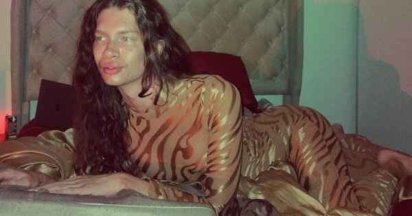 Donna gatto, €10mila di interventi per sembrare un felino - Radio 105