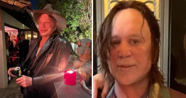 La trasformazione eccessiva del volto di Mickey Rourke - Radio 105